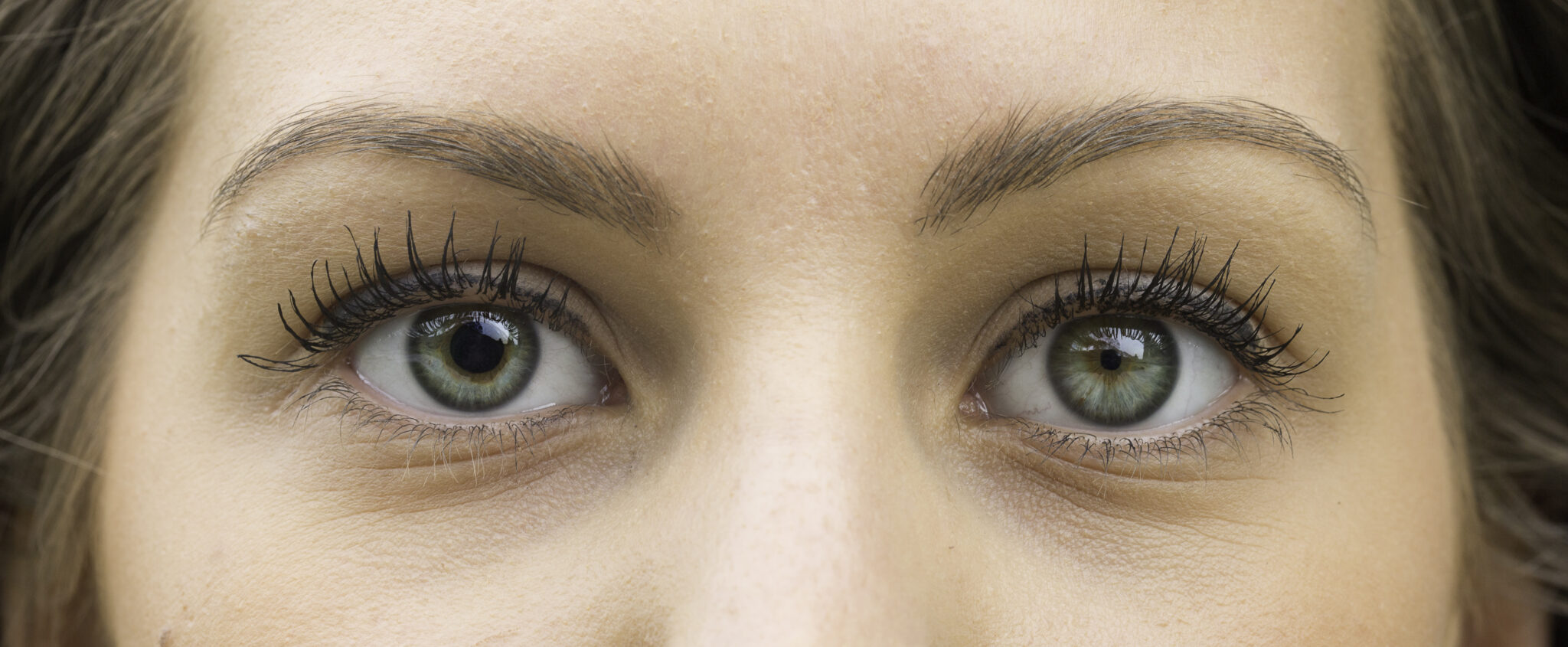 Why One Pupil Looks Bigger: When to See an Eye Doctor